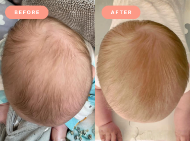The Perfect Noggin | Flat Head & Head Shaping Solution