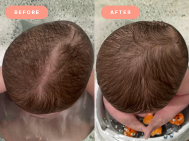 The Perfect Noggin | Flat Head & Head Shaping Solution